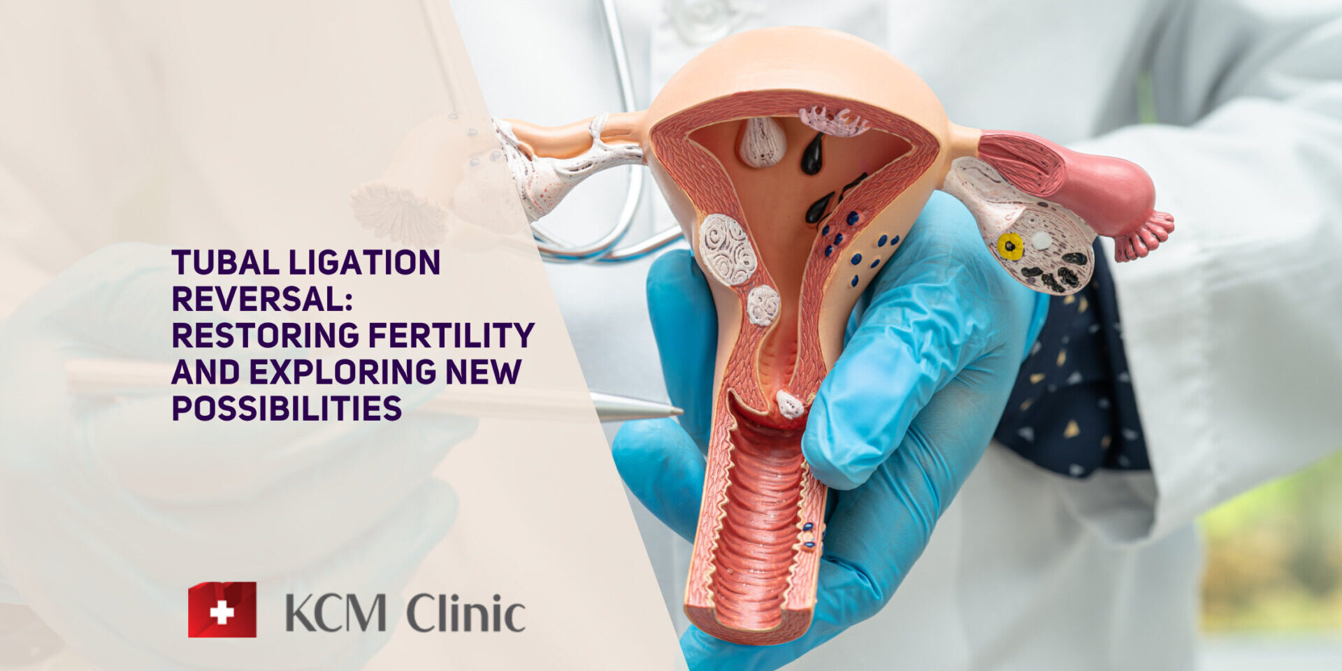 Tubal Ligation Reversal Restoring Fertility And Exploring New